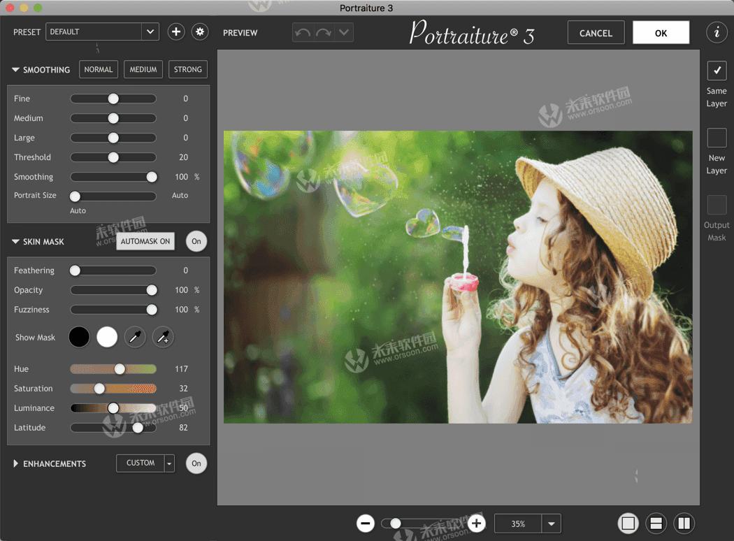 PS Smart Microdermabrasion Filter Software - iNEWS