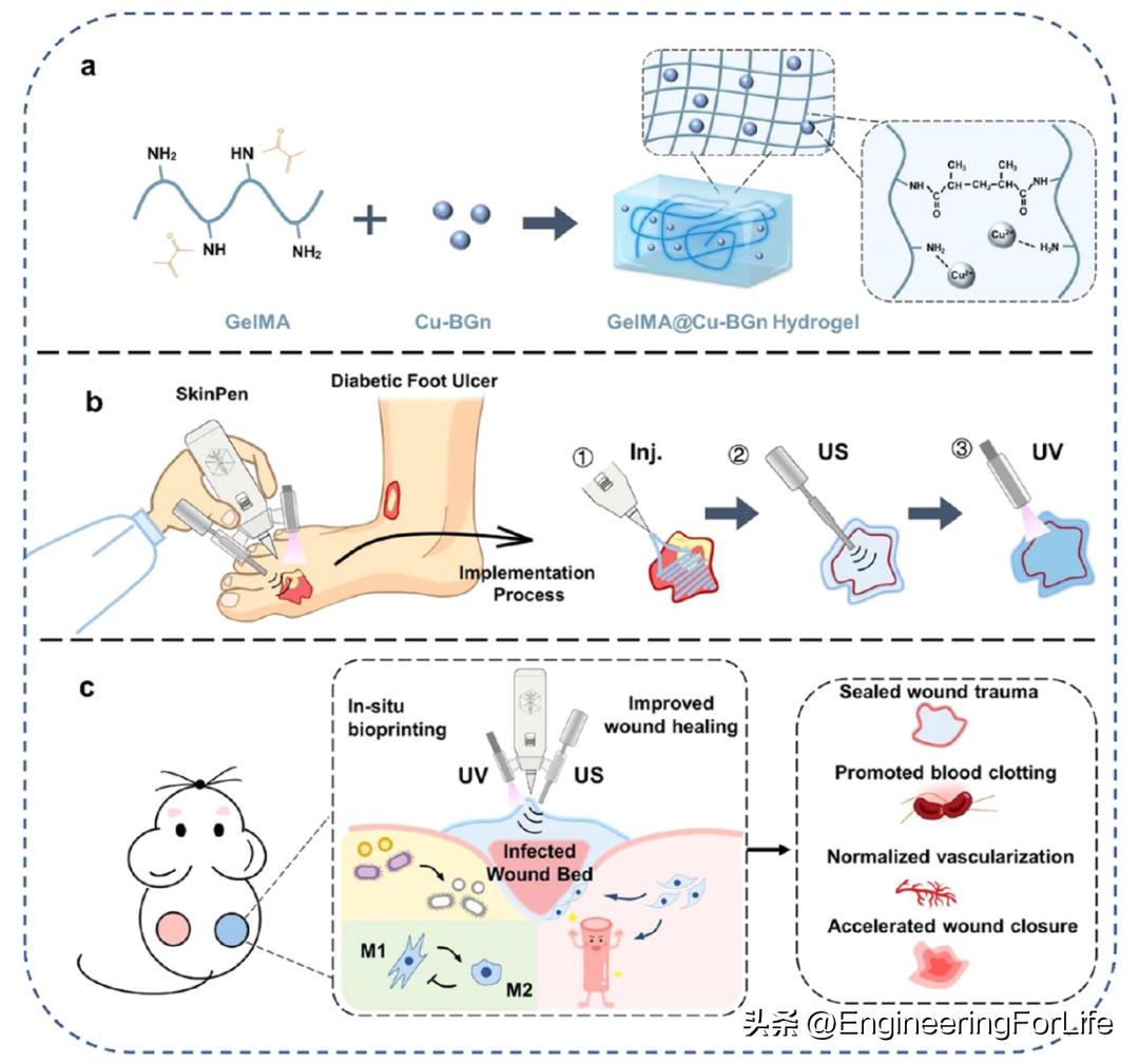 "ACS AMI": Ultrasound-enhanced adhesion bioink accelerates wound ...