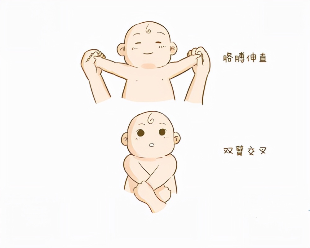 How to tell if the baby has high muscle tone? - iNEWS