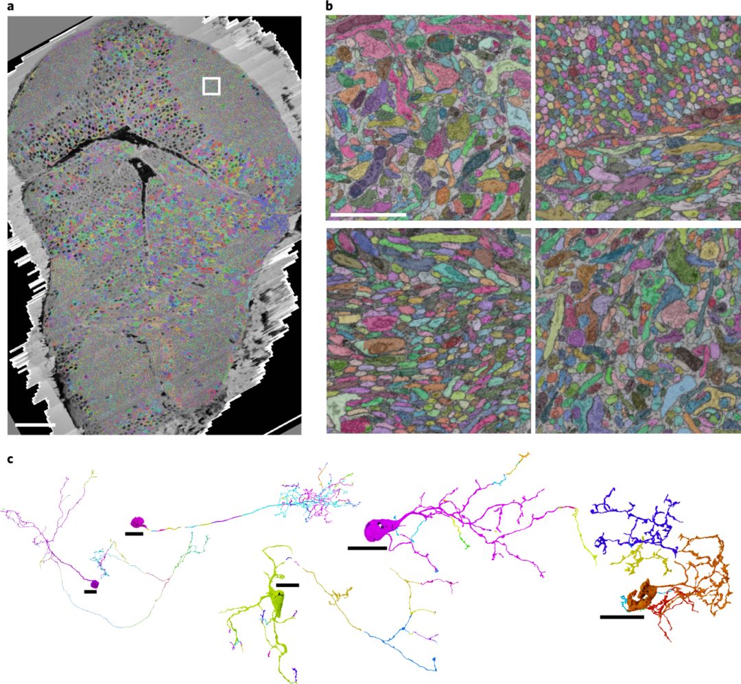 Automated synapse-level reconstruction of brain neural circuits, imagining future connectome ...