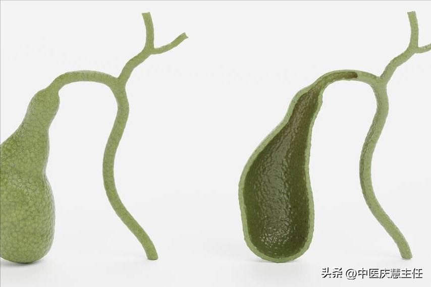 The root of chronic cholecystitis is damp heat in the liver and ...