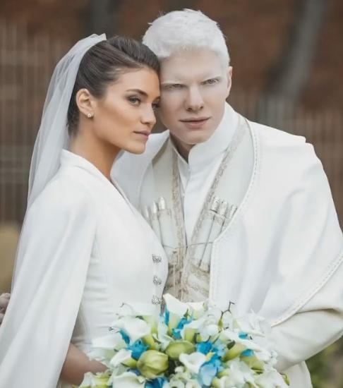 Georgia, the most handsome albino singer, married a young model, gave ...