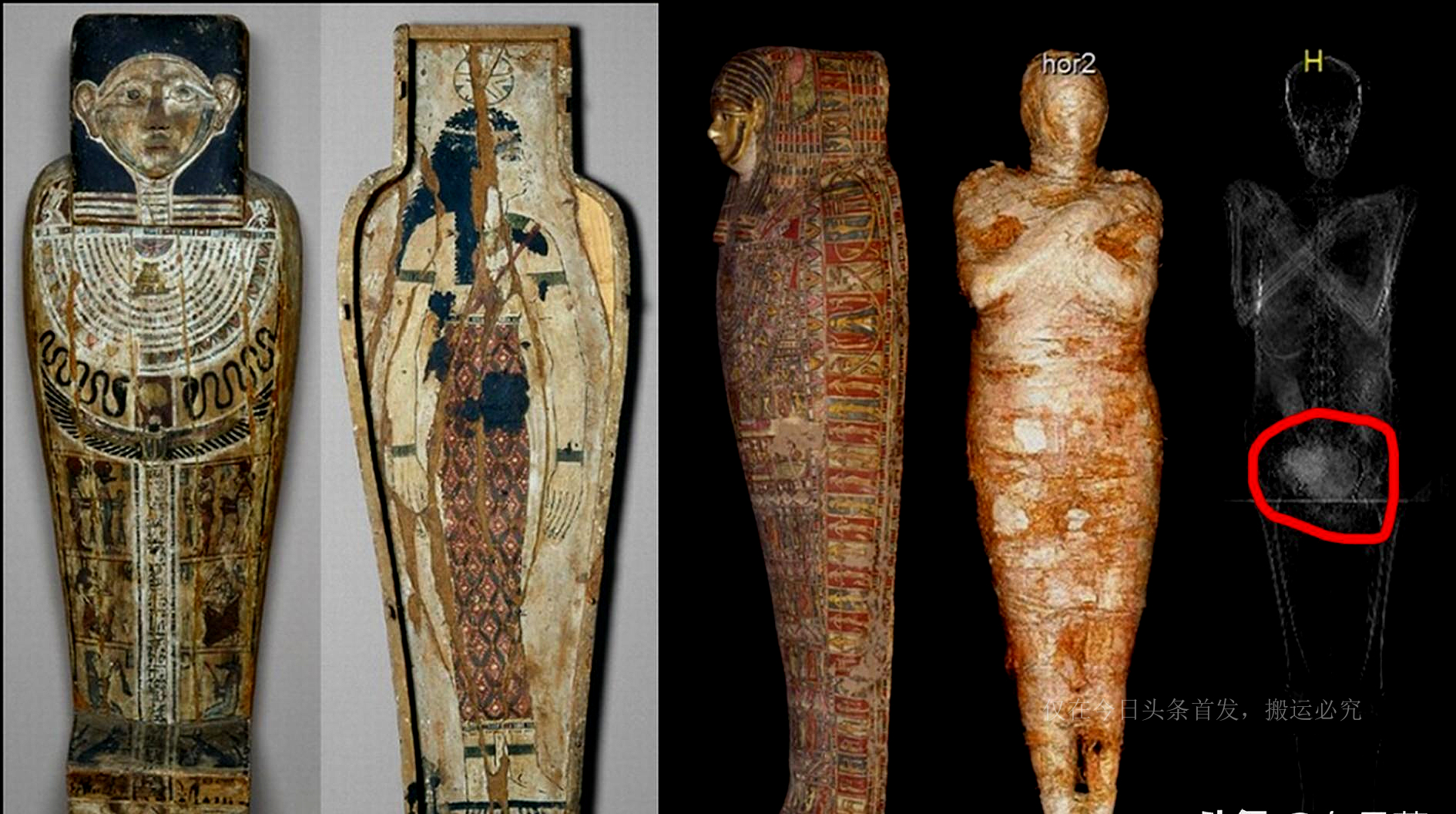 The world's first pregnant mummy appeared in the world, the fetus is 7 ...