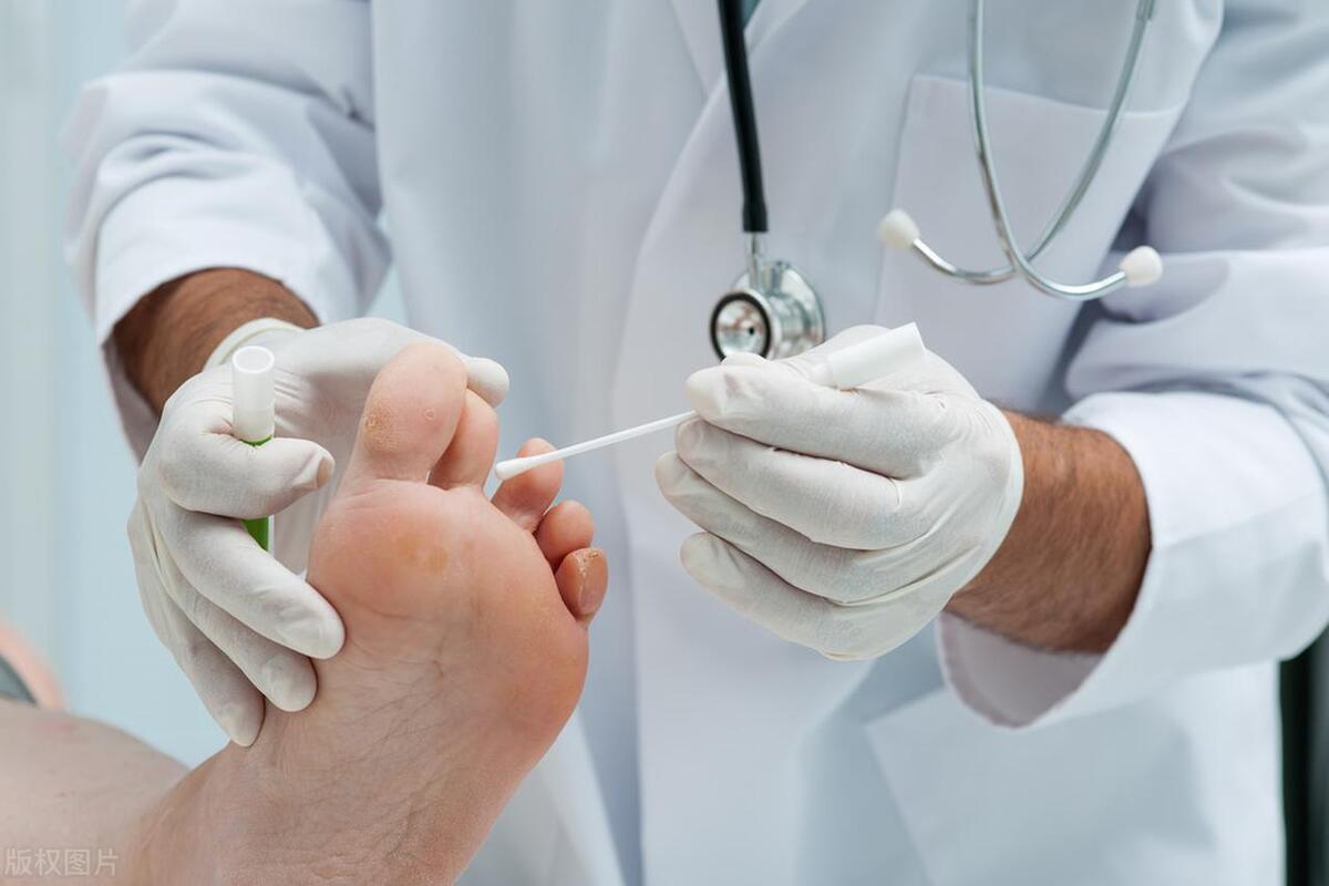Why are diabetics prone to rotten feet? Explore the root cause and ...