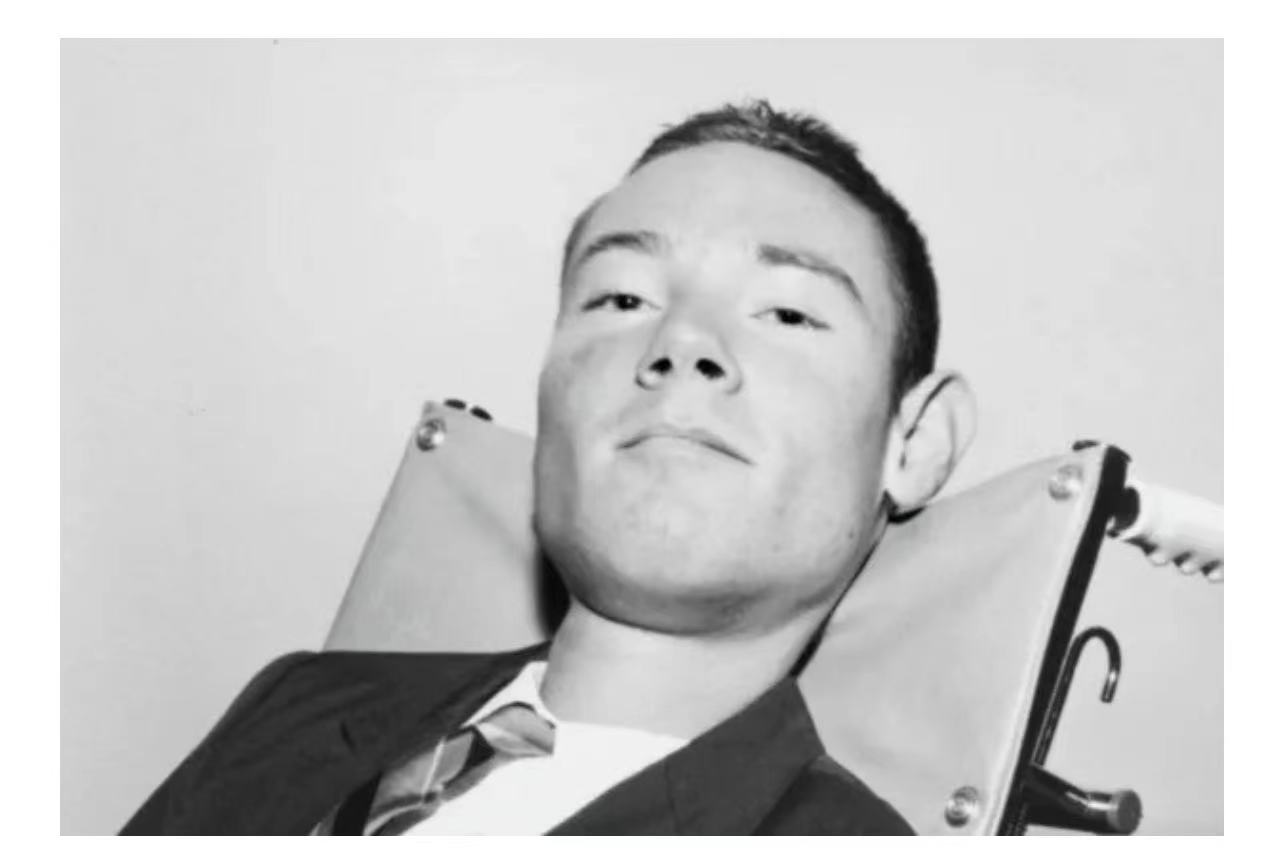 Strange anecdote: The iron lung man trapped in the "iron bucket" for 69 ...