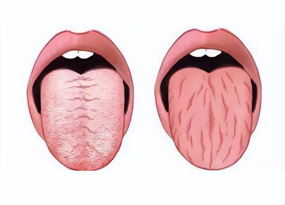 Oncologist Ma Dajun: How to know the physical condition through the ...