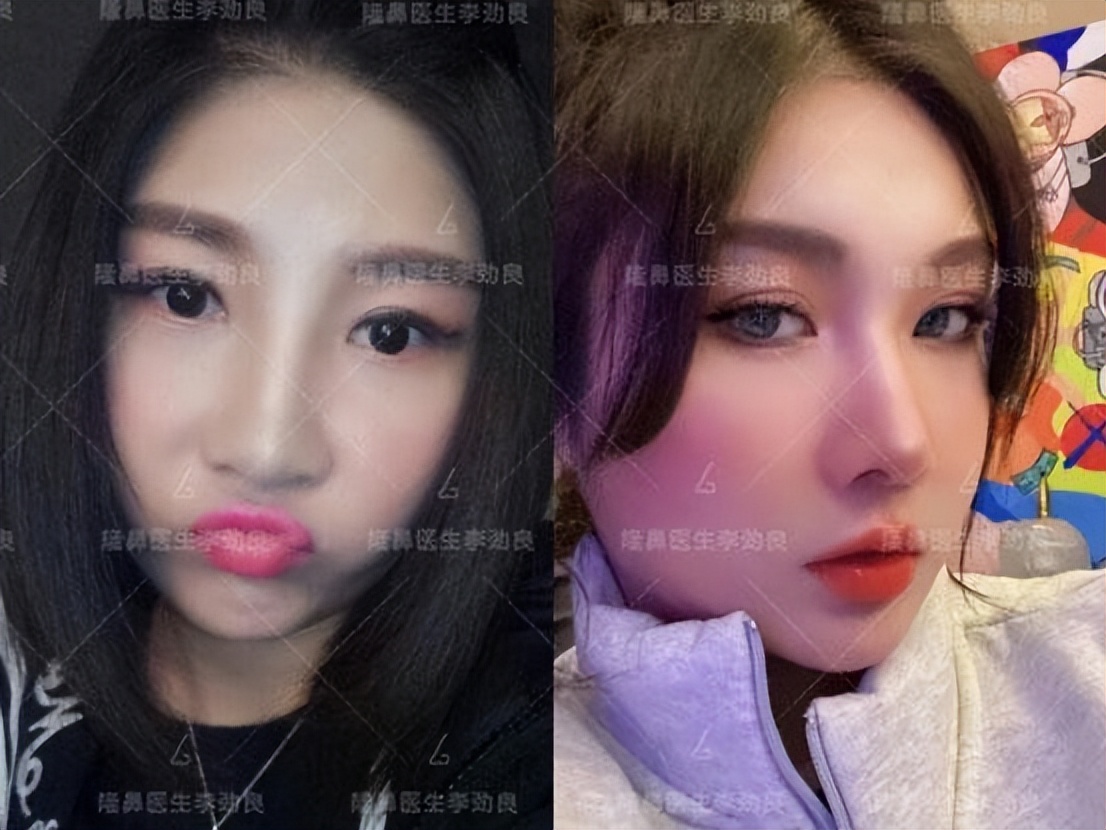 "Till The End Of The Moon" Luo Yunxi plastic surgery or skinny? This is ...