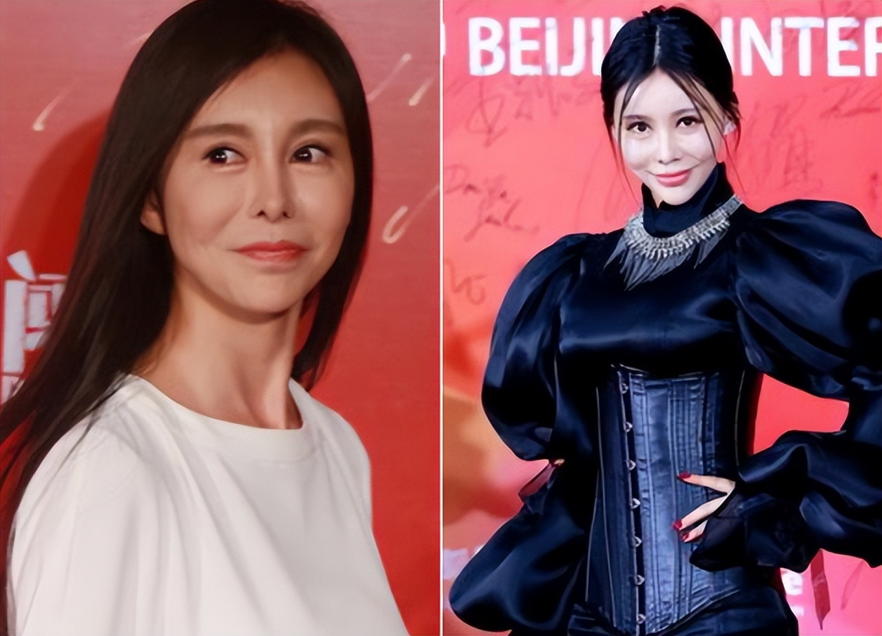 Artists fall in love with plastic surgery: It is very common to cut ...