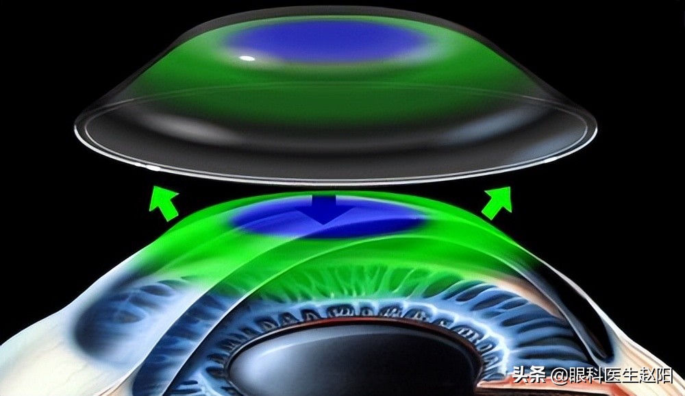 Lecture 4 (4) How to scientifically match glasses? - iNEWS
