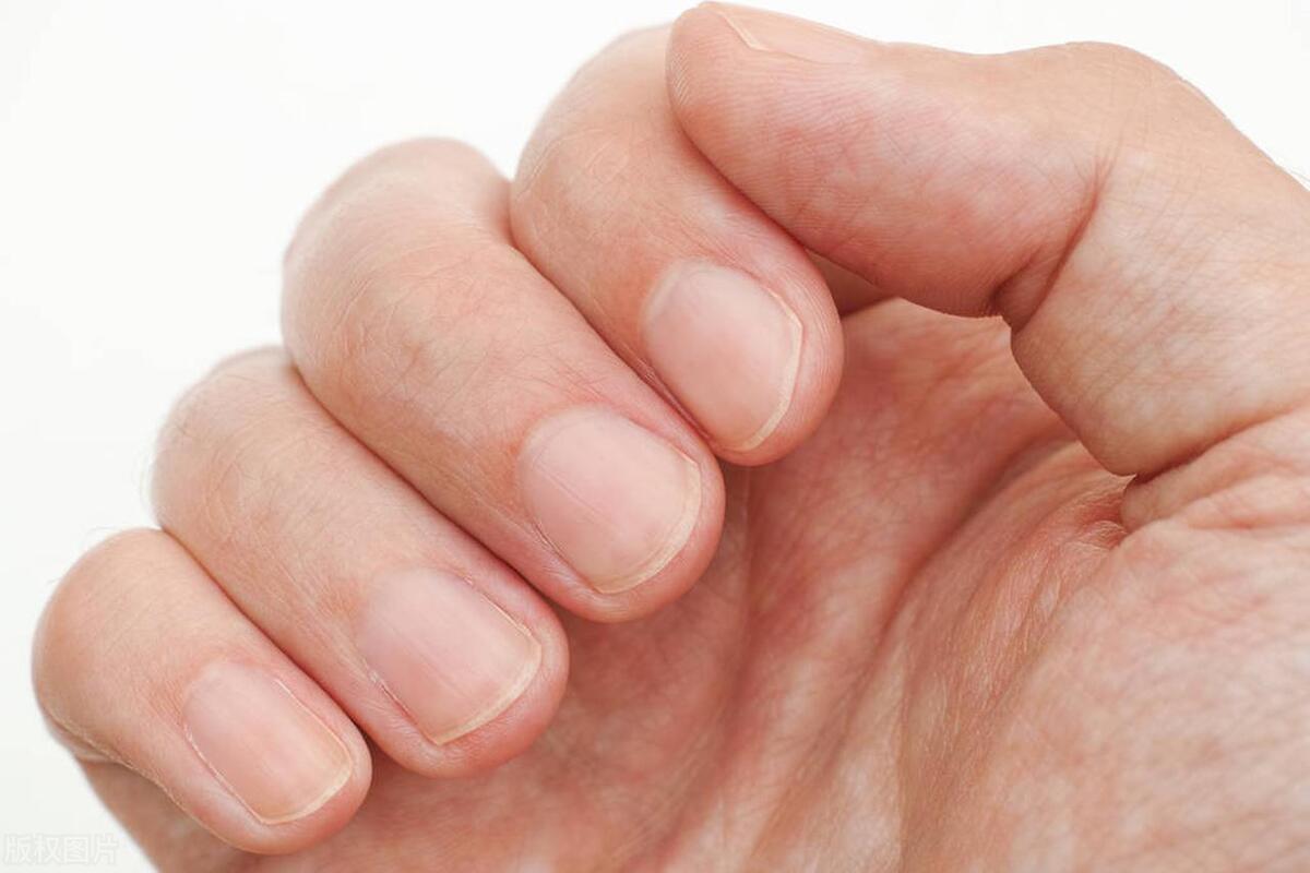 There are vertical lines on the fingernails, is the liver really bad ...