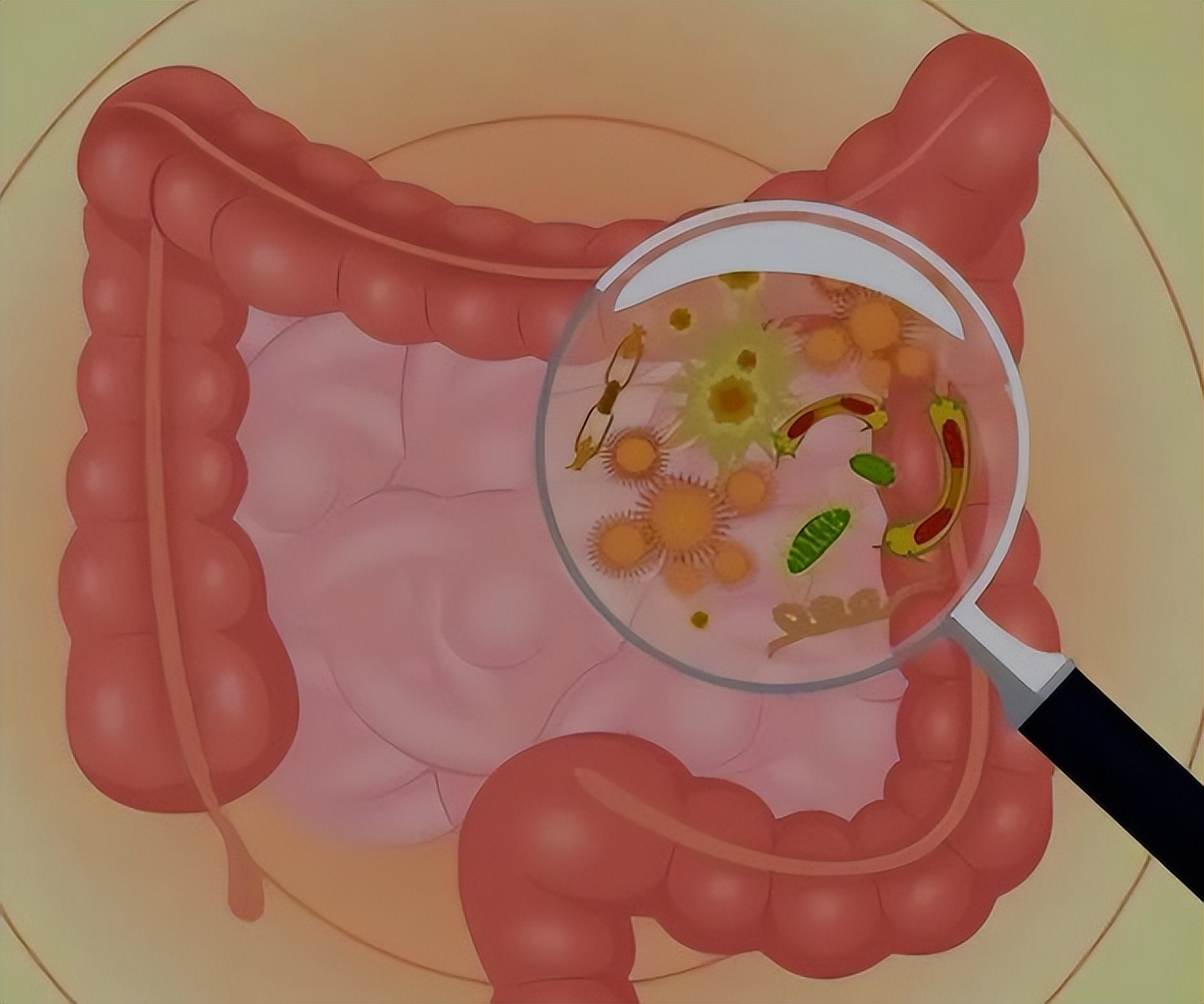 There are 6 kilograms of stool in the human body?How to get rid of ...