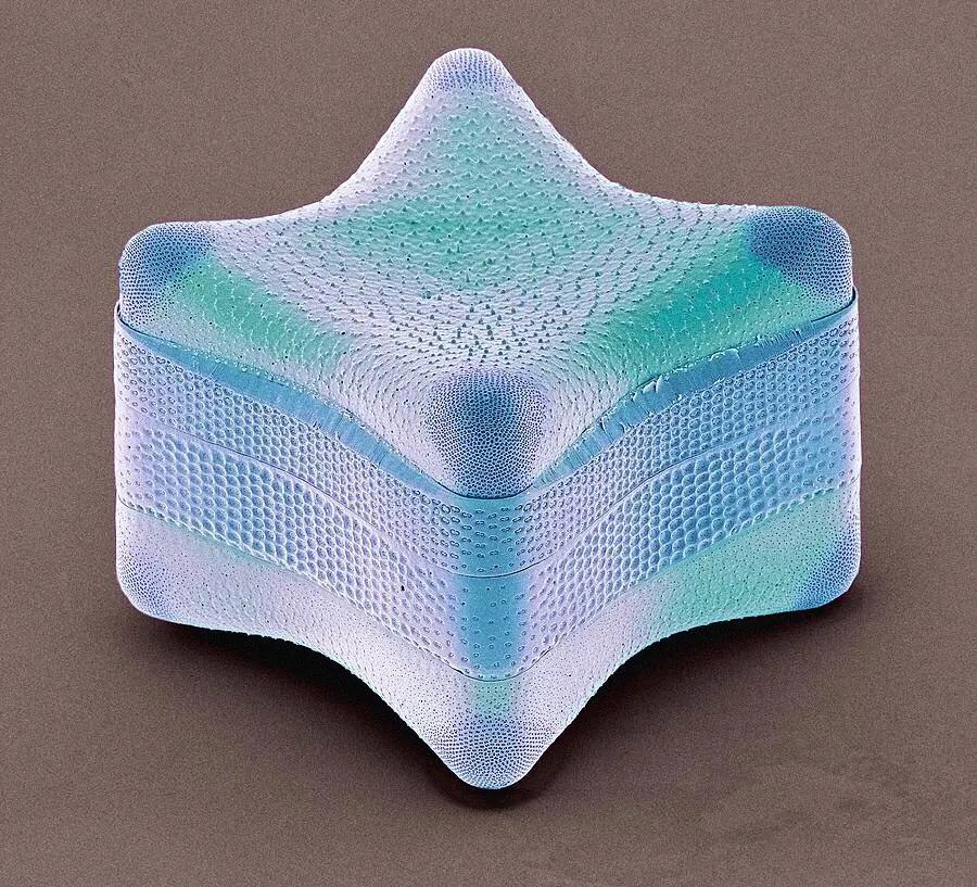 Amazing!Diatoms under the microscope look like the Colosseum - iNEWS