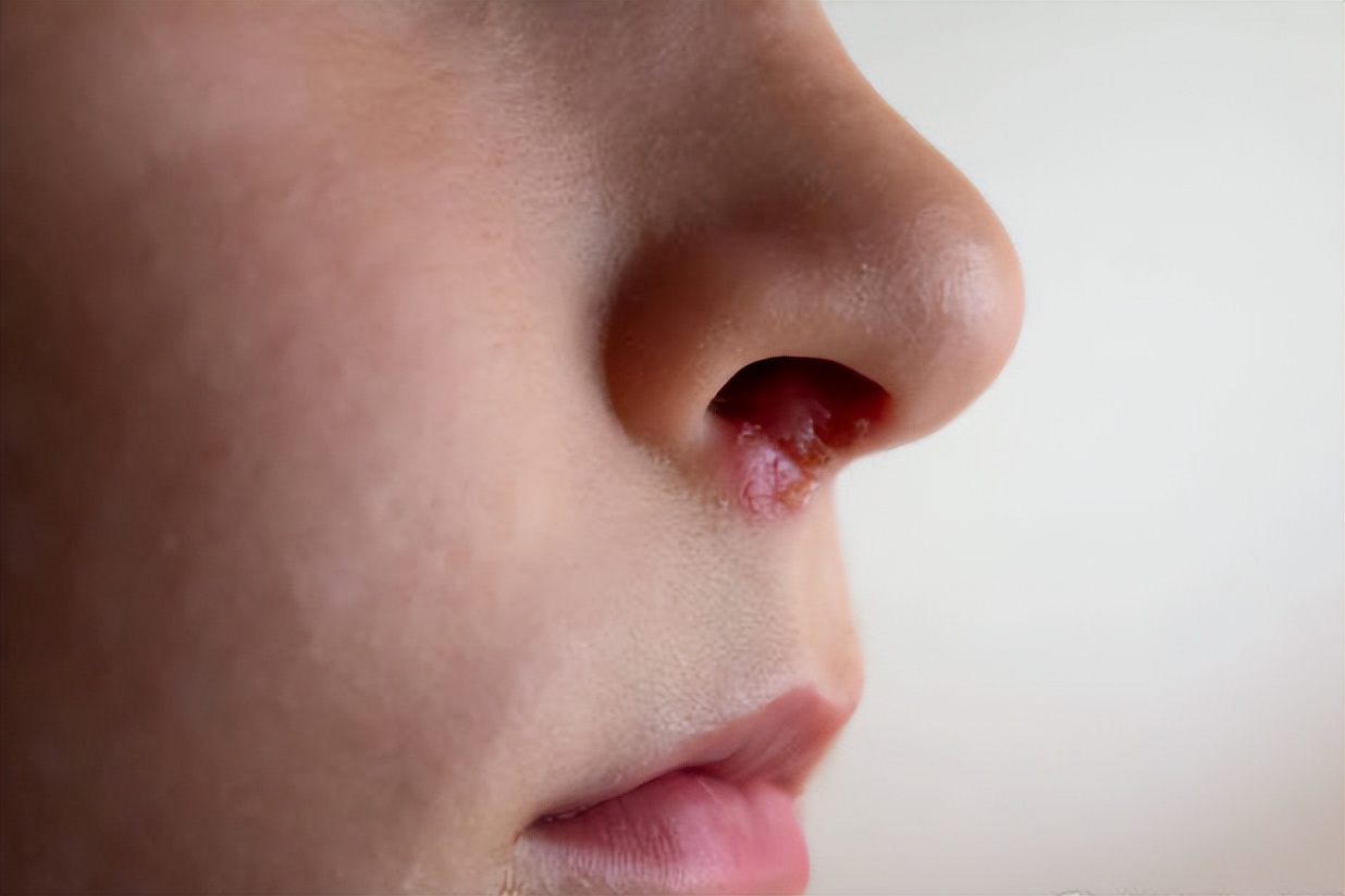 People who like to pick their noses will have to bear these 4 ...