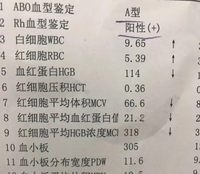 What exactly is panda blood?Why is panda blood so precious? - iNEWS