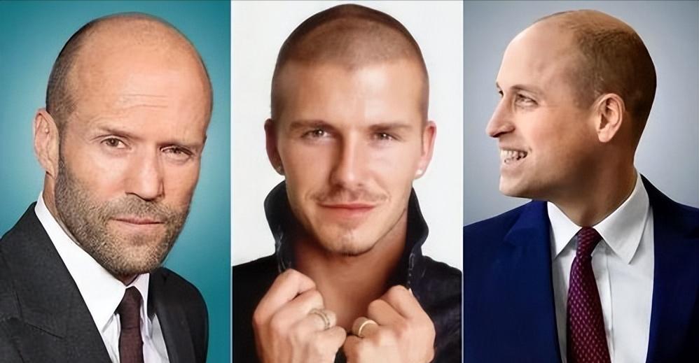 Nine bald men?Why are British men bald?Netizen: Drinking water will ...