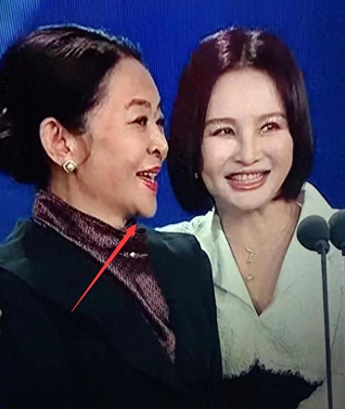 64-year-old Ni Ping underwent plastic surgery. Her "inverted triangle ...