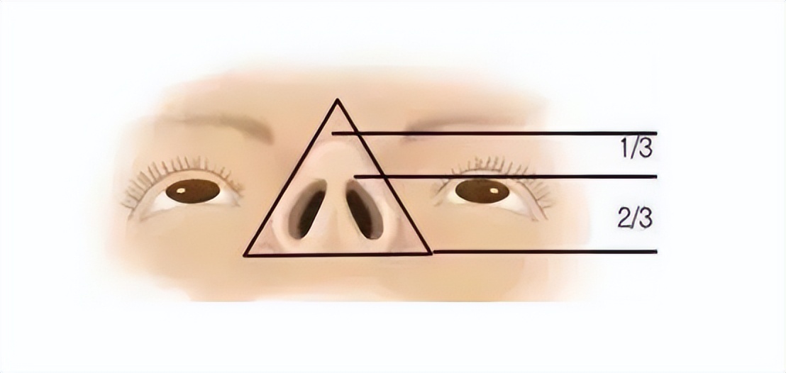 Chen Guocheng: Does the hook nose look good?Why are some people ...