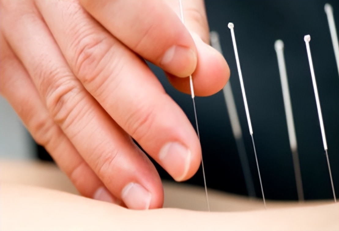 Can paralysis caused by stroke still be saved? Can acupuncture be used ...