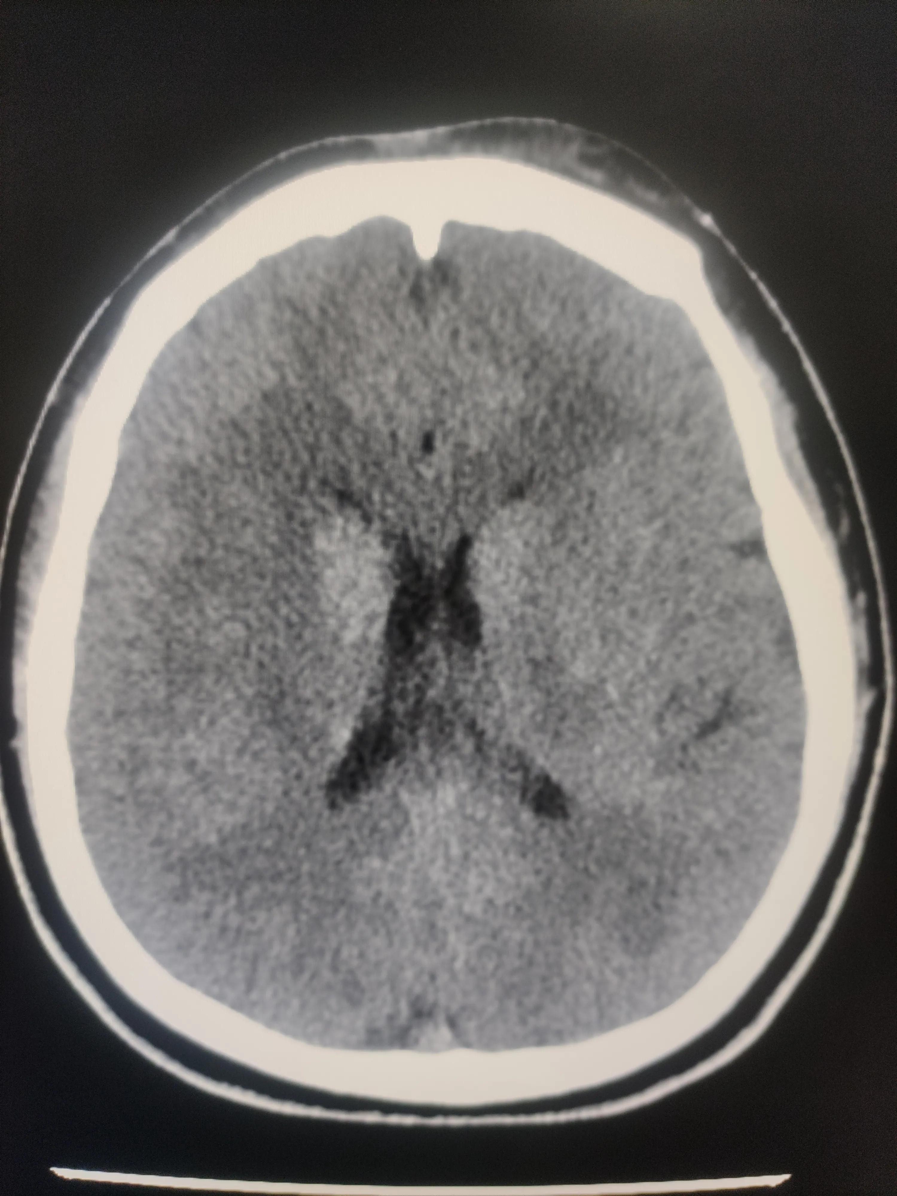 What is the difference between CT and MRI? - iNEWS