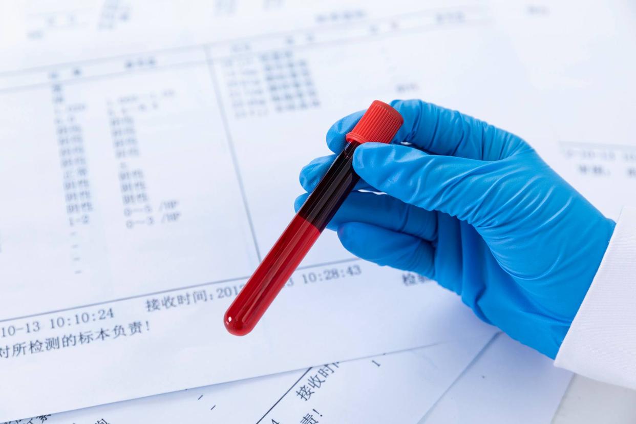What diseases can blood tests detect? Doctor's reminder: If the 5 ...