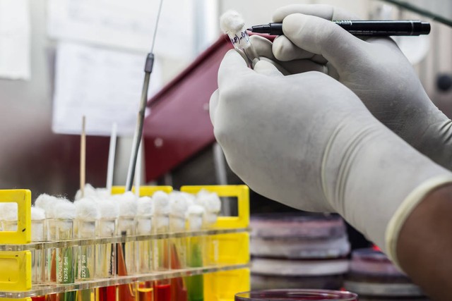 Correlative low-temperature super-resolution light and electron ...