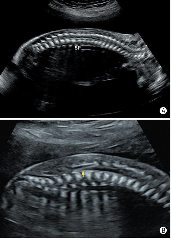 The latest "Ultrasound Prenatal Screening Guidelines" 06_Fetal face and ...