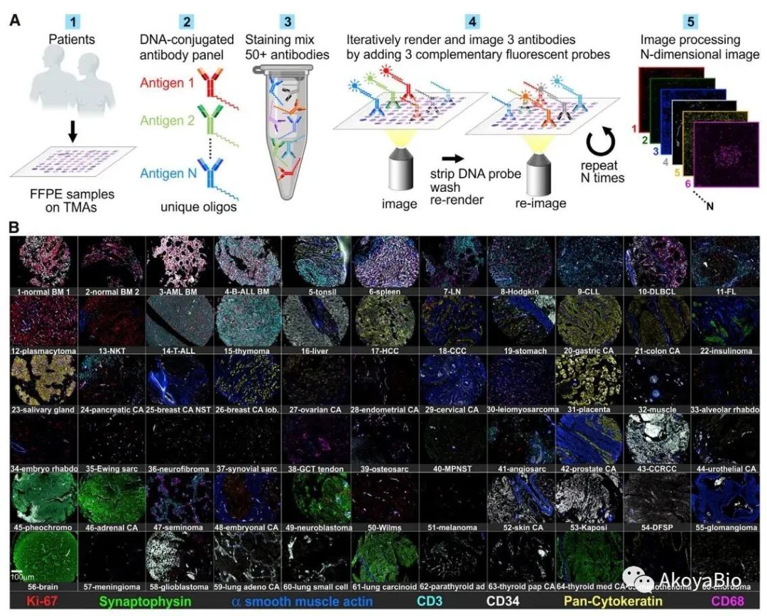 Appreciation of Akoya's Classic Cases of Spatial Biology and Tissue ...