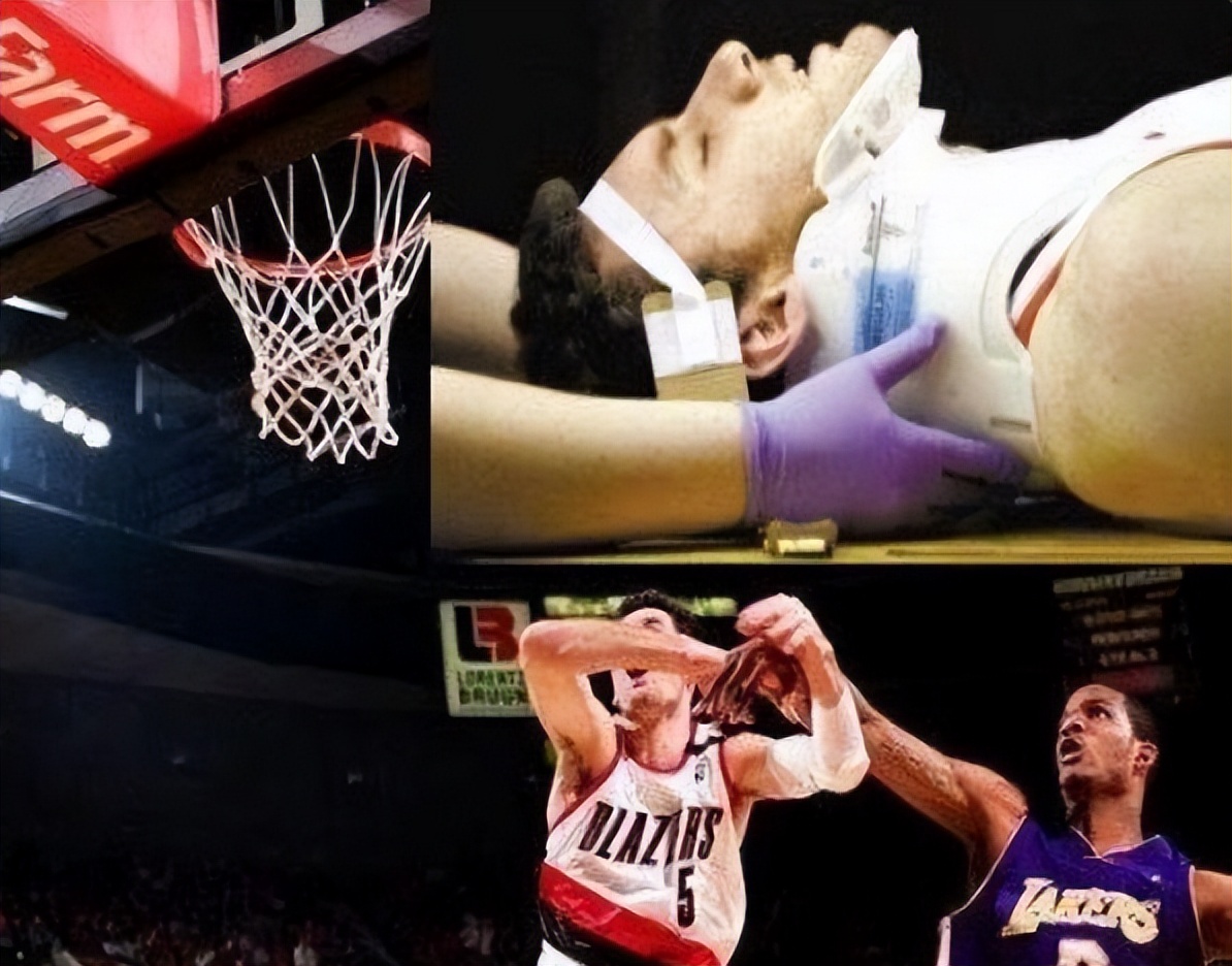 NBA5大惡意傷人事件，有人肺部萎縮 有人差點丟了命 - 頭條匯