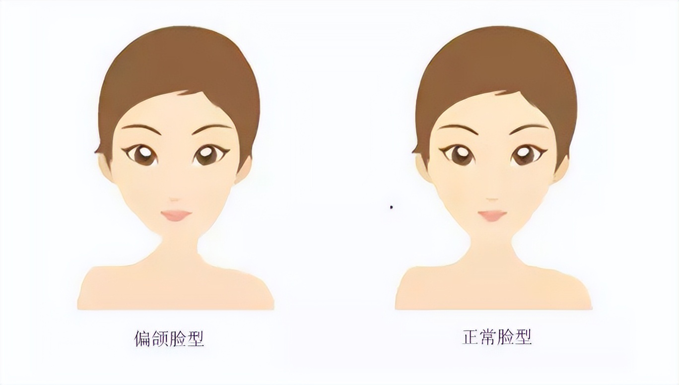 How should jaw deviation be treated? - iNEWS