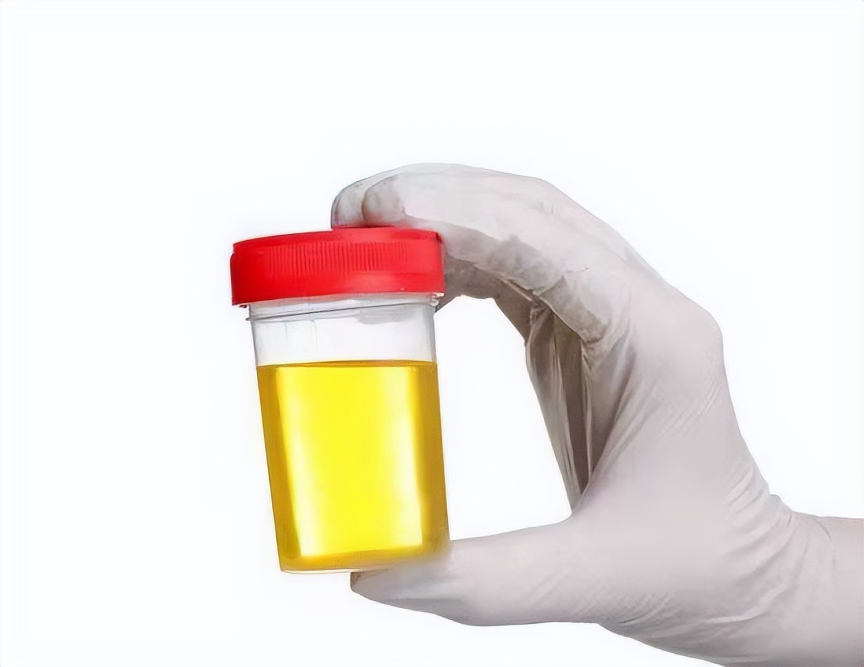 Oliguria and edema, why does heart failure lead to decreased urine ...