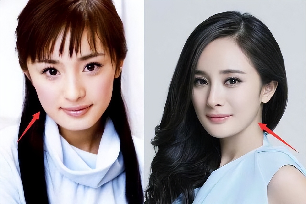 The chin is sunken and the nose is transparent. It is obviously a ...