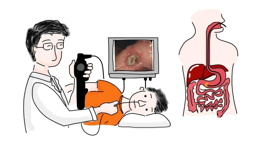 Gastrointestinal endoscopy can save lives at critical moments ...