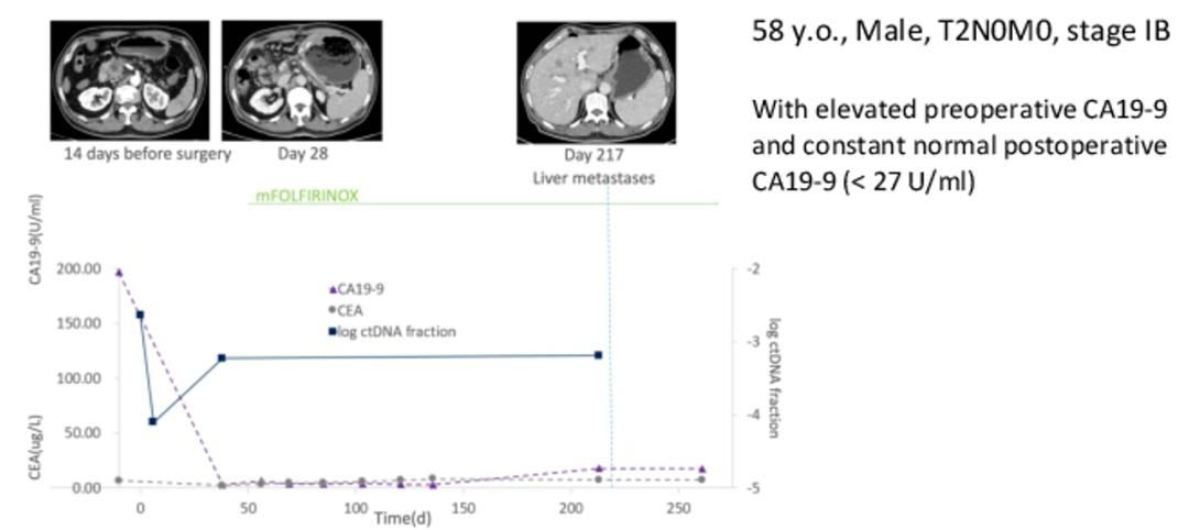 A new ctDNA detection technology can be used to predict the early ...