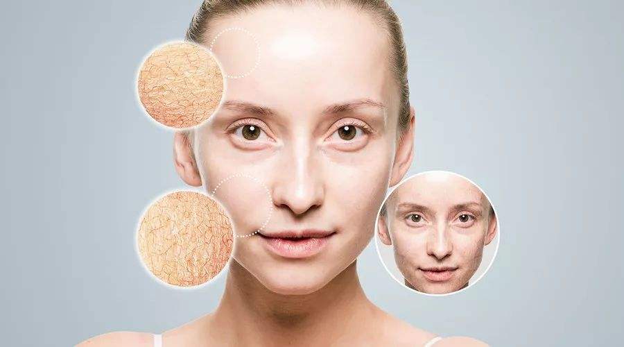 4 manifestations of damaged skin barrier!Let's see if you got hit? - iNEWS