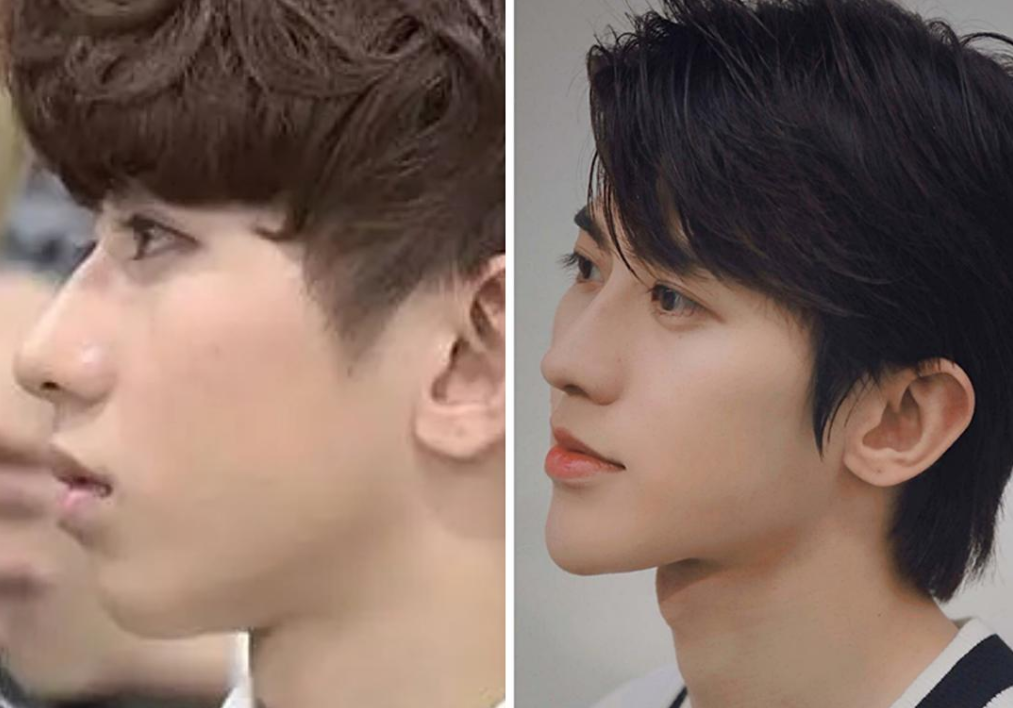 The "fancy fake chin" competition in the entertainment industry is ...