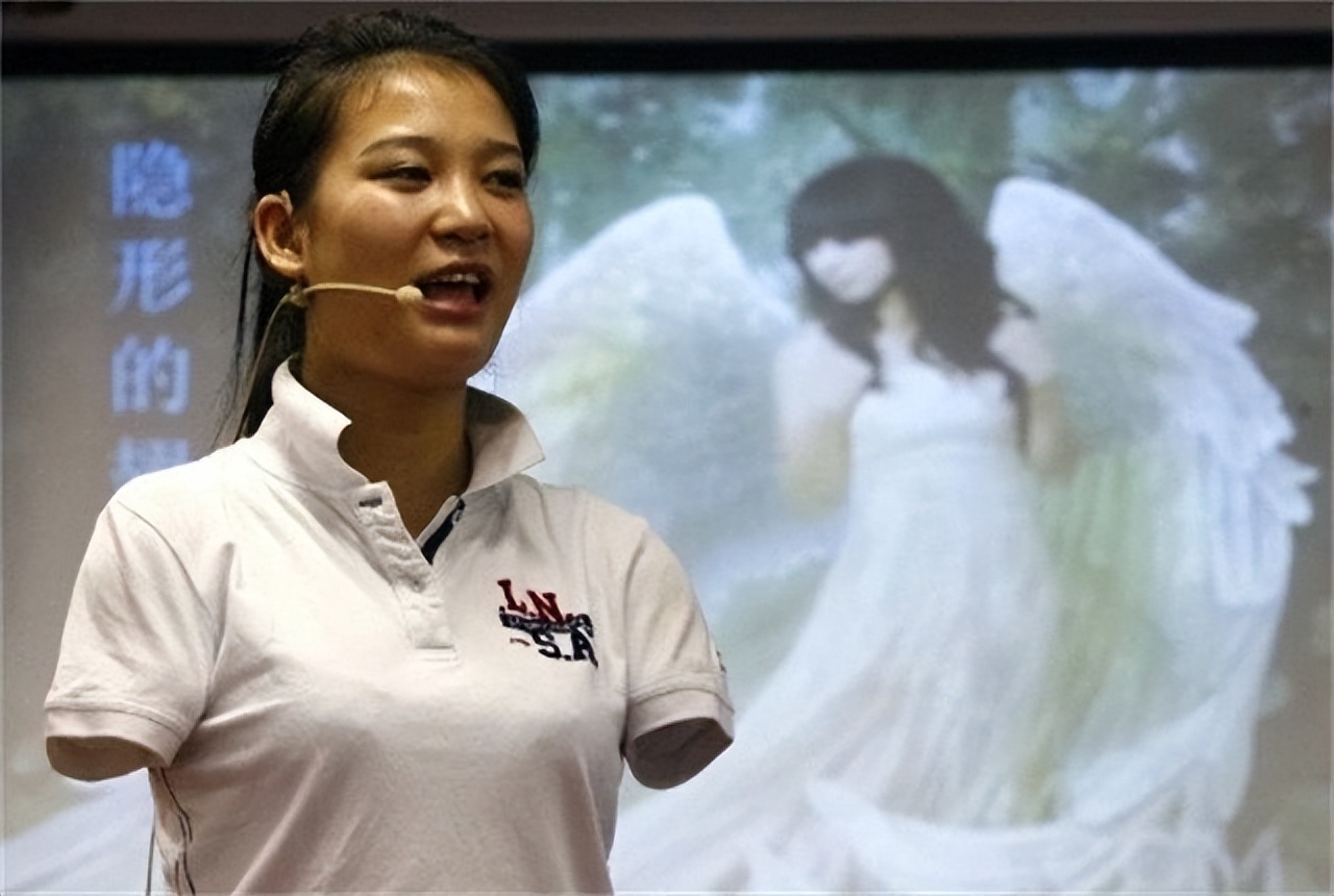 "Girl with Broken Arm" Lei Qingyao: 3-year-old amputated with only ...