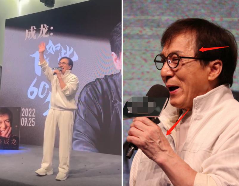 In recent times, Jackie Chan's skin is slack and blue veins burst out ...