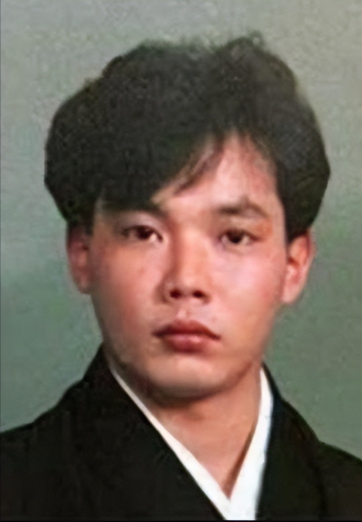 The victim of the Japanese nuclear leak, whose whole body festered, was ...