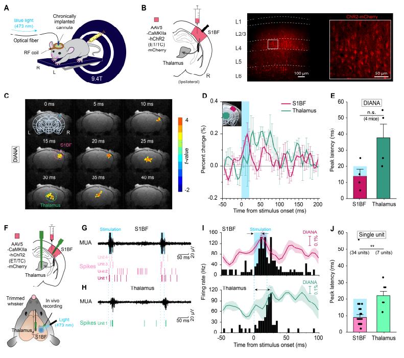 Neuroimaging ushered in reform, South Korean scientists achieved direct ...