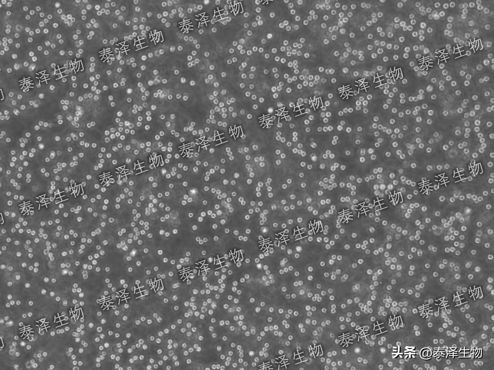 CA46 人Burkitts淋巴瘤細胞 - 資訊咖