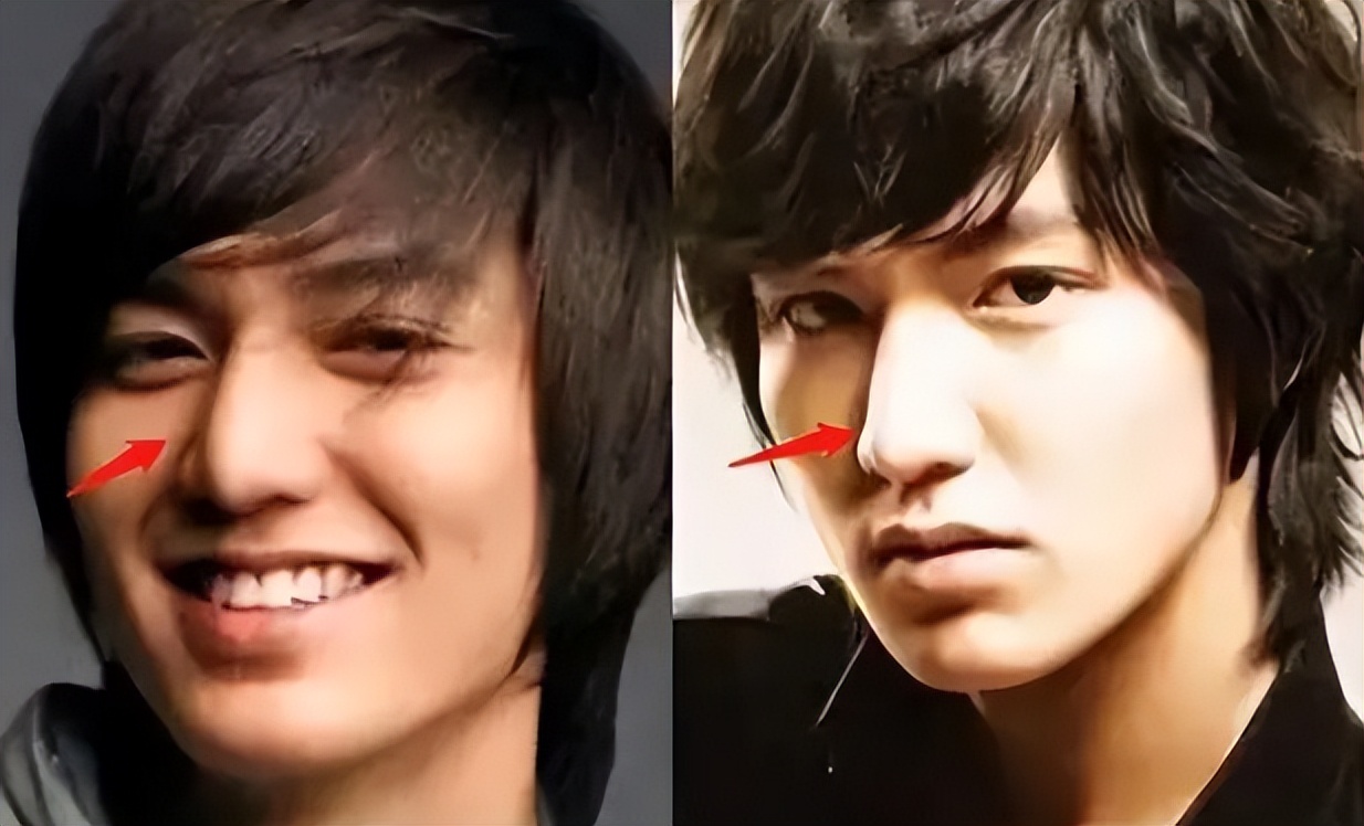 A recent photo of Lee Min Ho at the age of 36 was exposed, with a ...