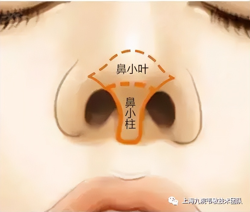 Do you understand the elongation of the nasal columella? - iNEWS