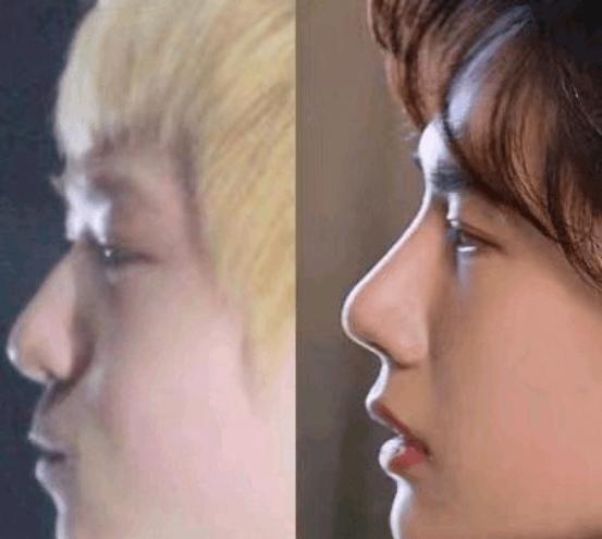 "Transparent nose, hooked nose", the stars of the entertainment circle ...