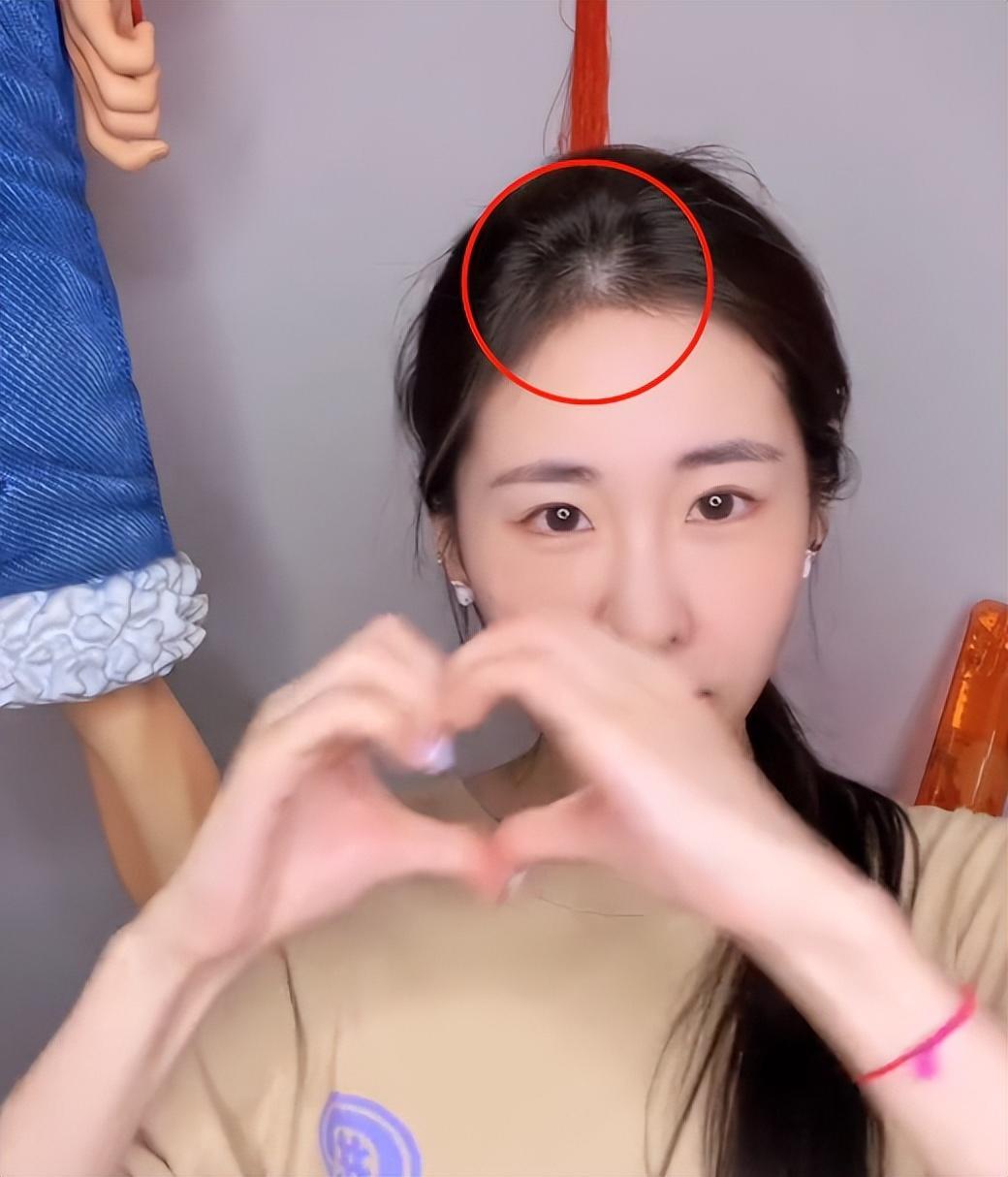 Zhang Bichen is caught in a plastic surgery storm, with a crooked mouth ...