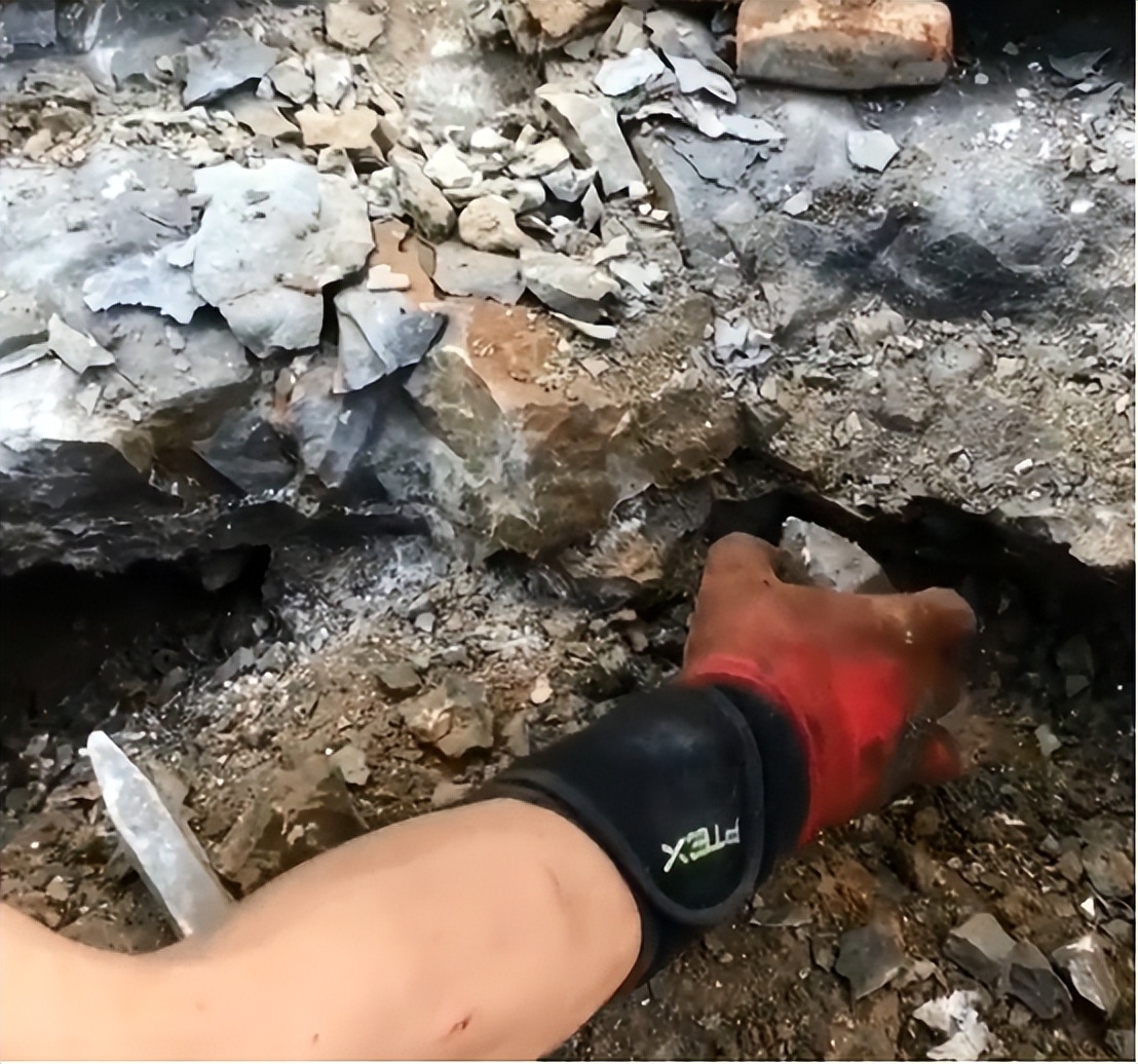 The man drank 1,400 bottles of nuclear radiation water, his bones ...