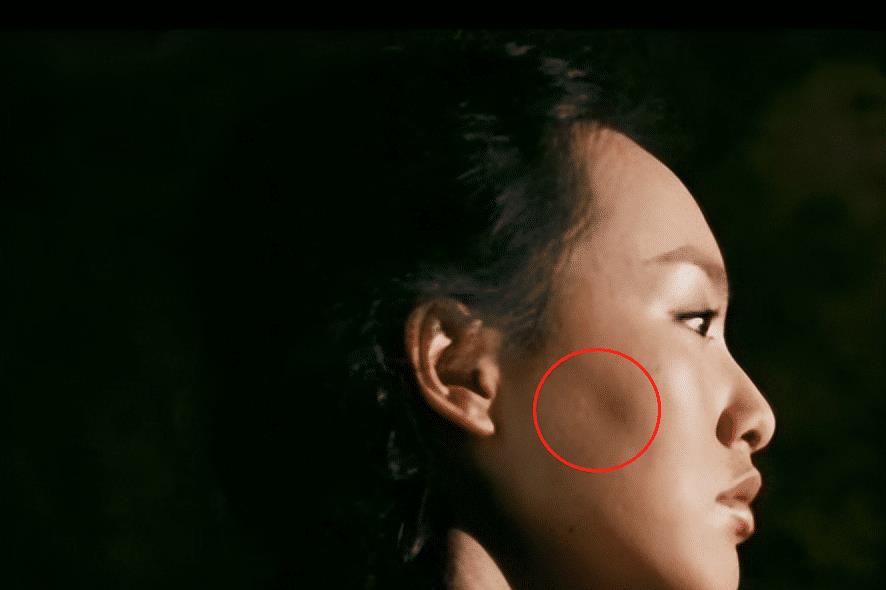 Protruding mouth, short chin, flat nose, sunken face...the profiles of ...