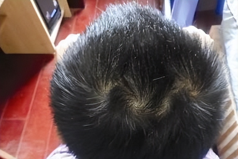 What does the "spin" on a child's head represent?Is it related to IQ ...