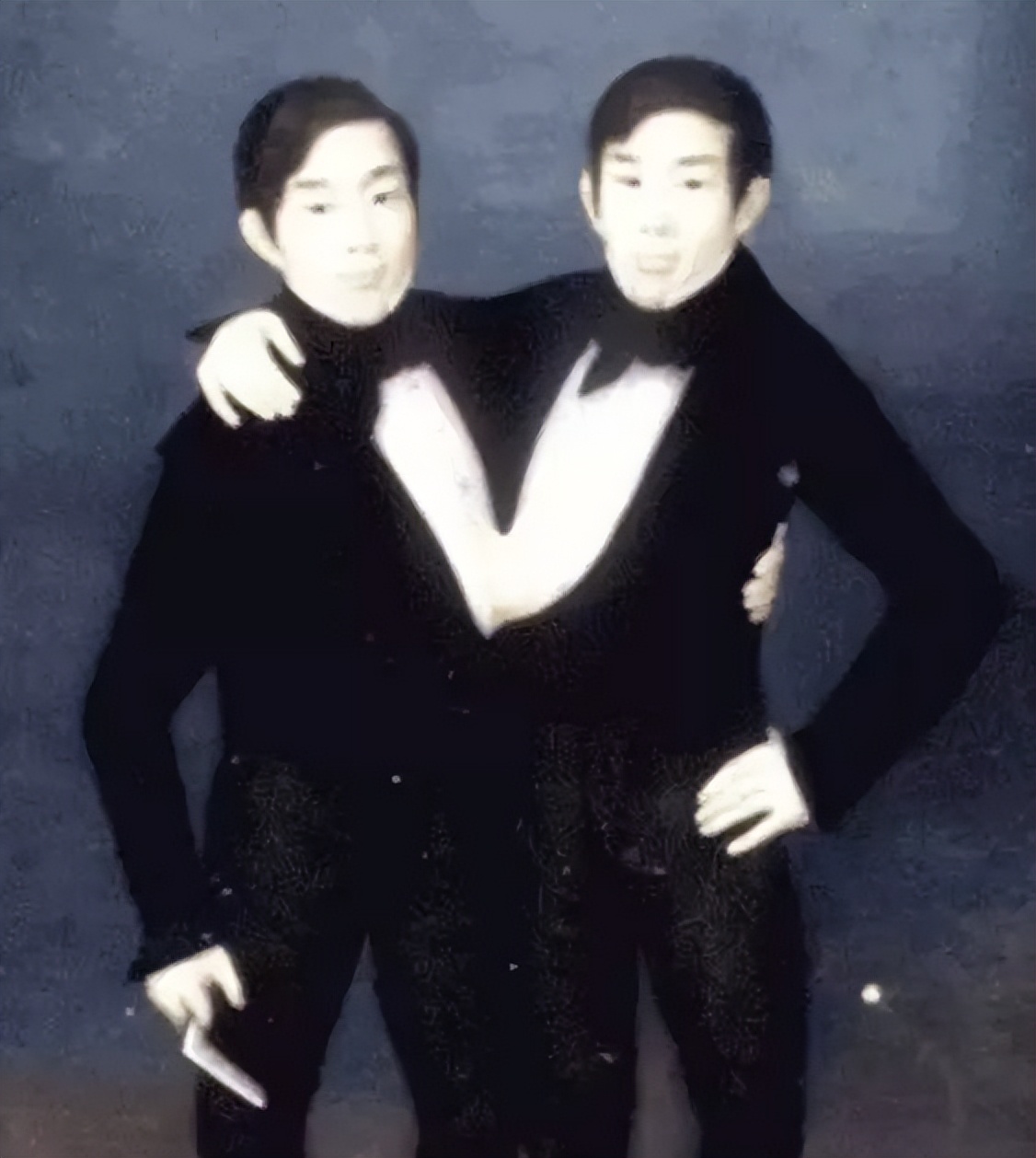 Chinese conjoined brothers marry British twin sisters Hua, have 22 ...