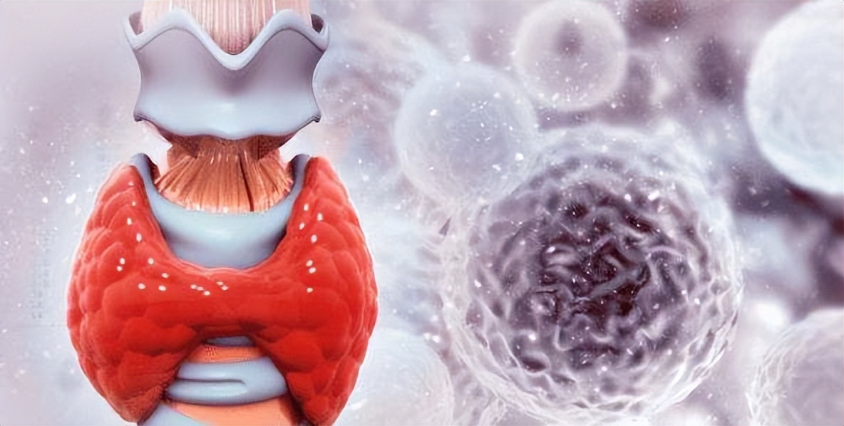 Correct understanding of Hashimoto's thyroiditis, these 8 symptoms ...