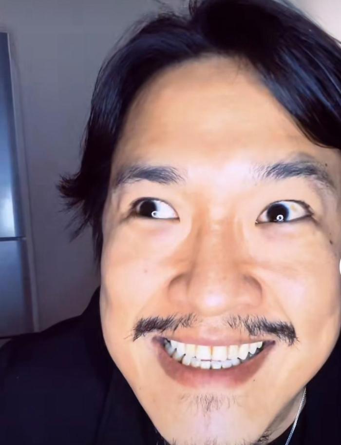 Lu Liping's 35-year-old son is extremely haggard: his eyes are weird ...